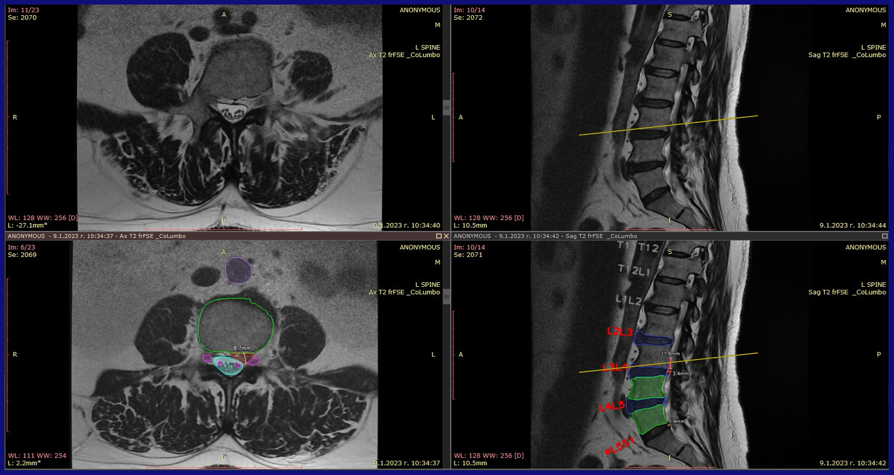 - Imapôle Lyon-Villeurbanne