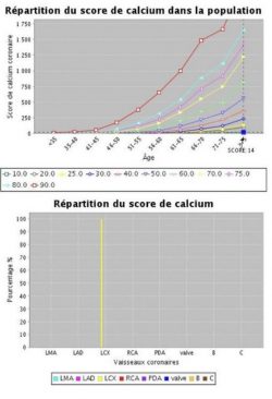 Scanner à Lyon - Imapôle Lyon-Villeurbanne
